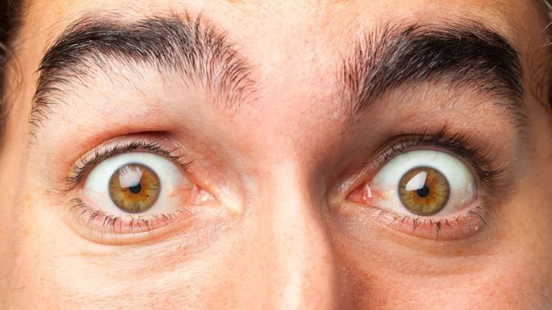 Mắt tam bạch là gì? Luận giải tướng số người mắt tam bạch